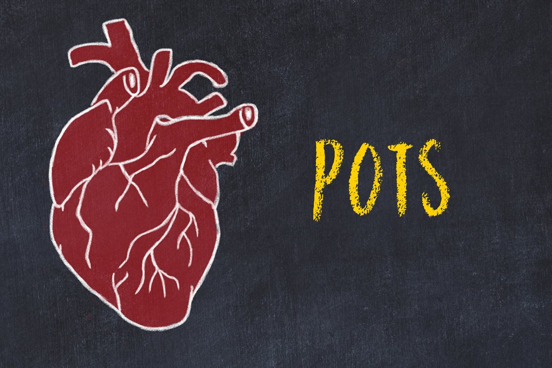 Ivabradine shows efficacy in treating postural orthostatic tachycardia ...