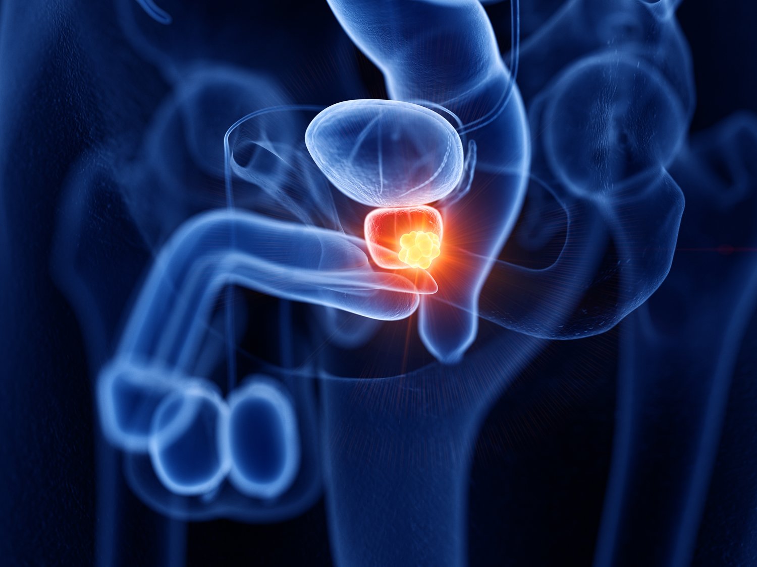 EMA validates MAA for relugolix for the treatment of advanced prostate ...