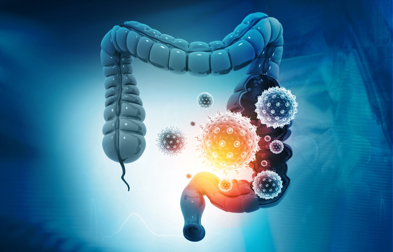 Persistence pays off in the human gut microbiome - Medical Update Online