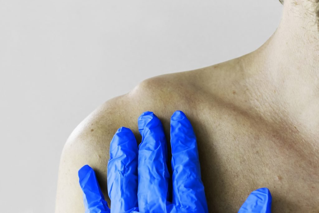 Patient-specific plates may help heal collarbone fractures - Medical ...