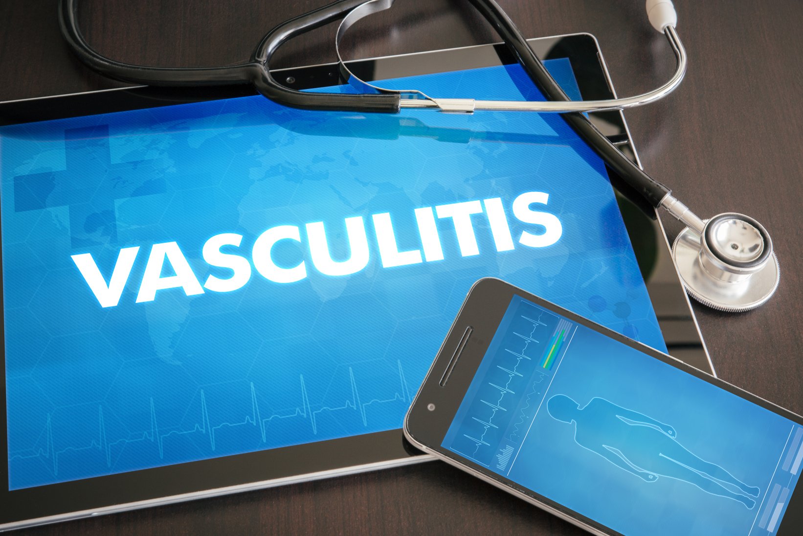 ChemoCentryx announces approval in Japan of Tavneos for the treatment ...