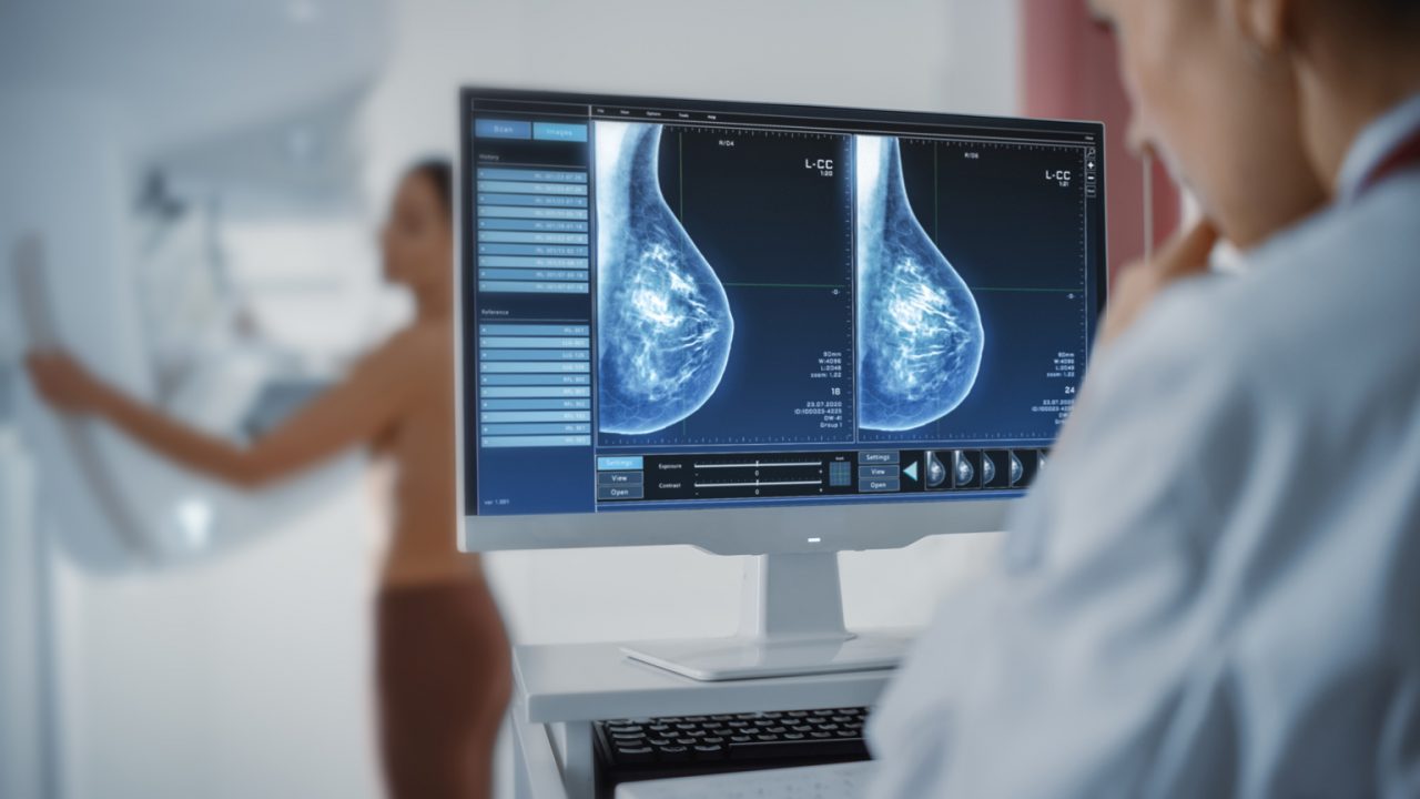 AI provides accurate breast density classification - Medical Update Online