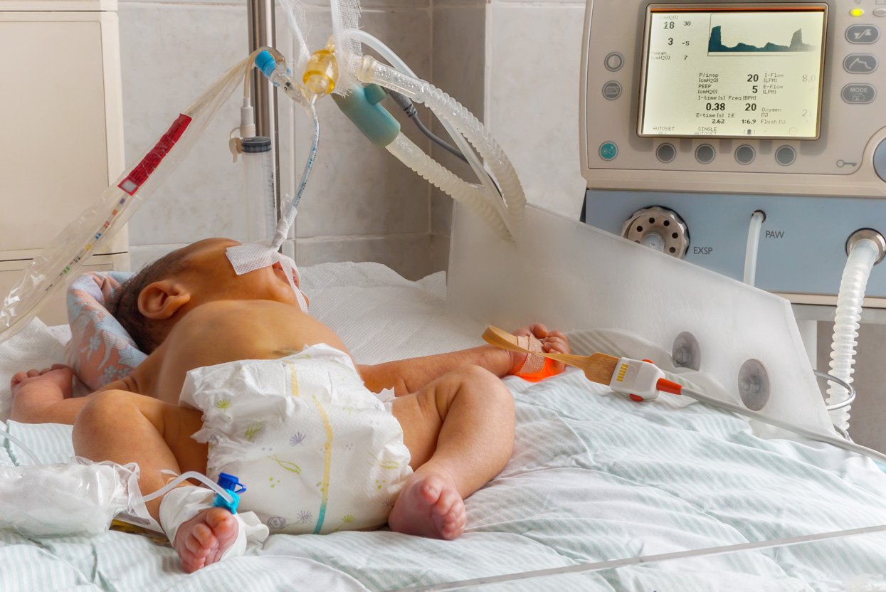 3 systems develop together for baby's respiratory health - Medical ...
