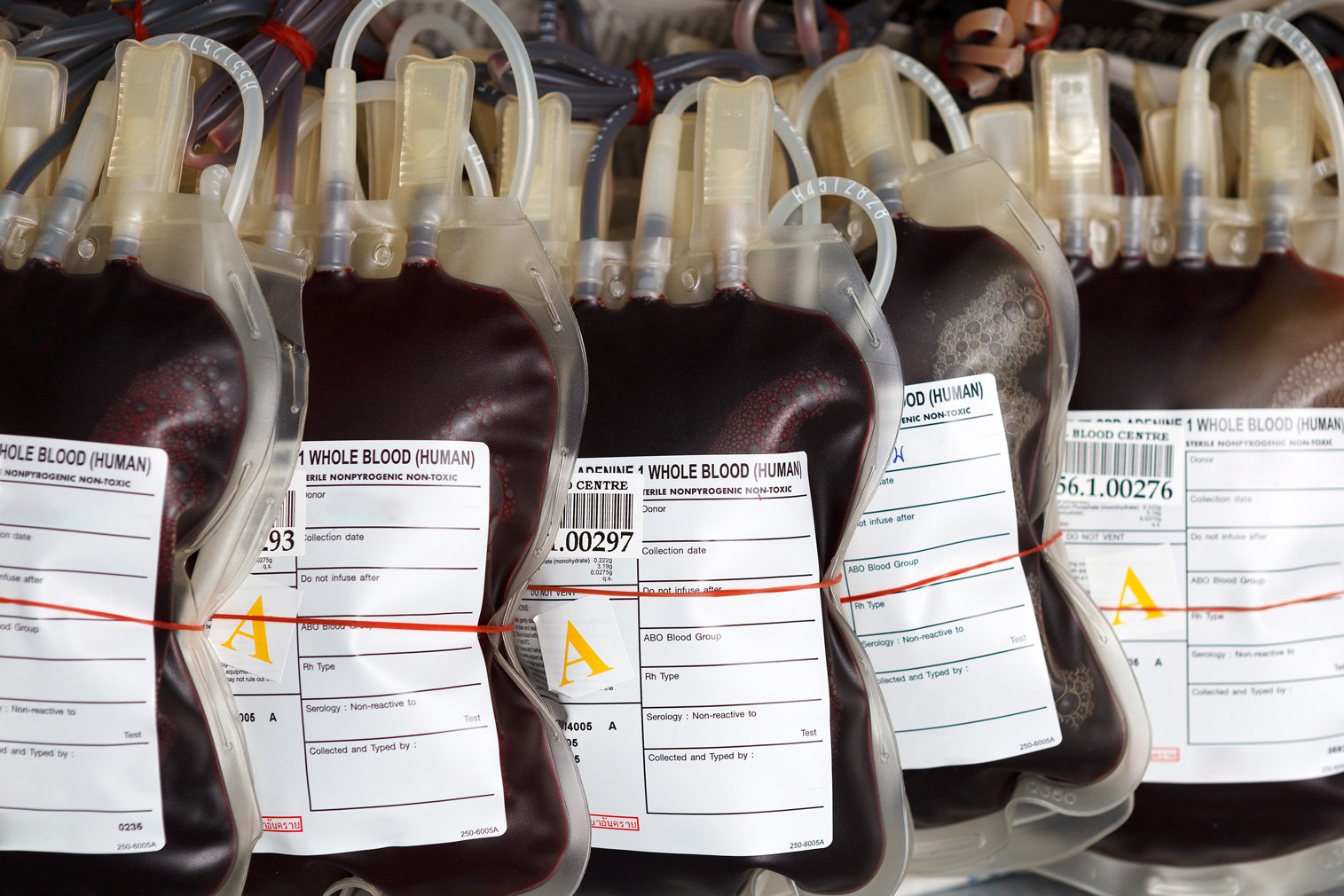 New research to help address blood shortages in Ireland - Medical ...