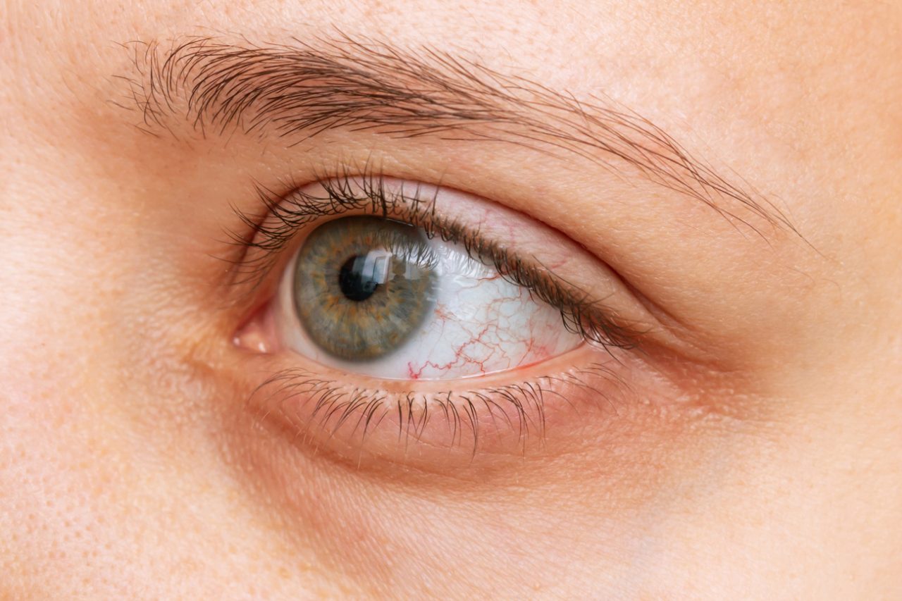 New diagnostic option for rare eye disease - Medical Update Online