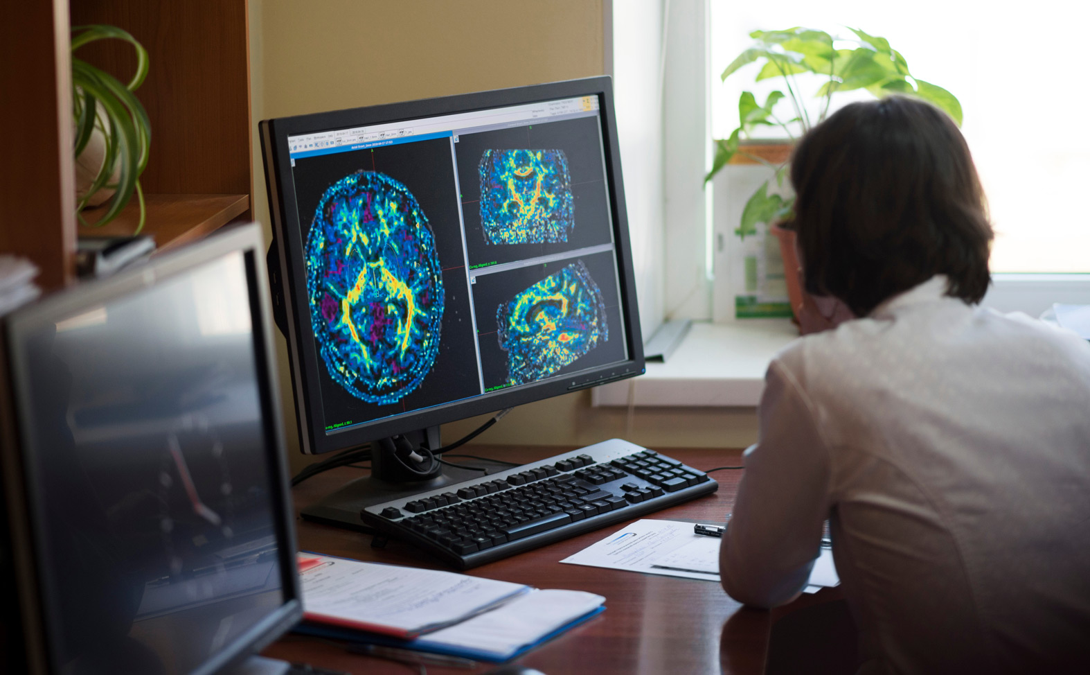 Trained radiographers may be a solution for the radiologist shortage ...