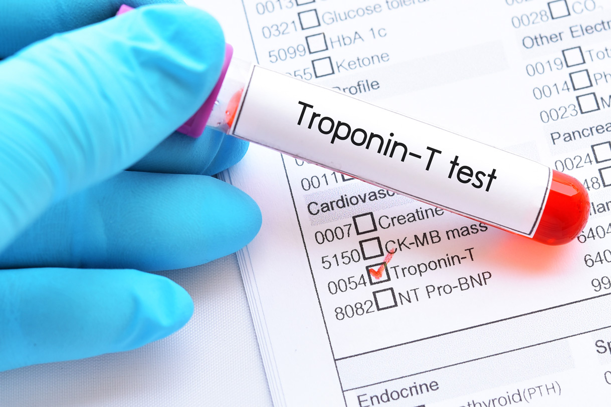 New troponin test improves heart attack diagnostics - Medical Update Online