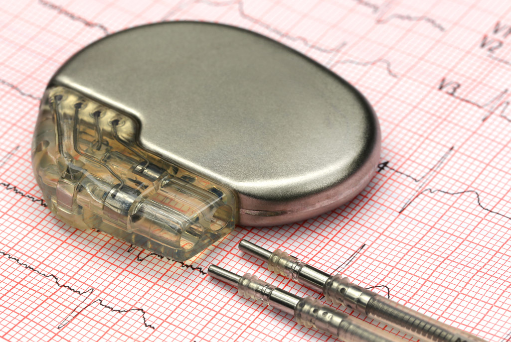 Leadless pacemakers soon available for all patients - Medical Update Online