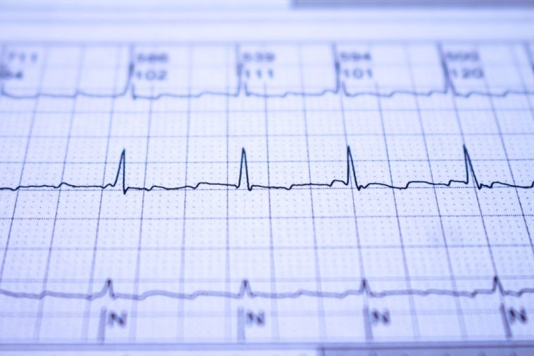 FDA approval for PulseSelect Pulsed Field Ablation (PFA) system for the ...