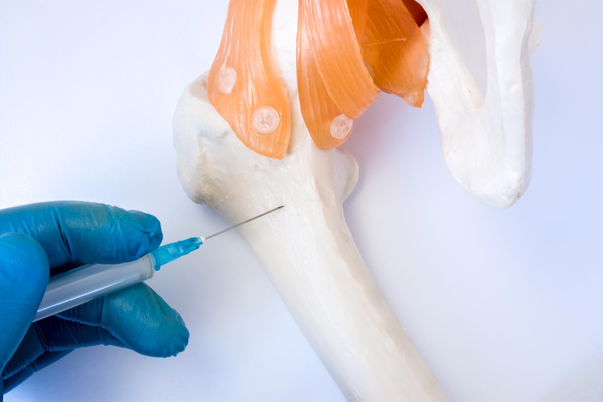 FDA grants clearance for first-ever digital bone marrow aspirate ...