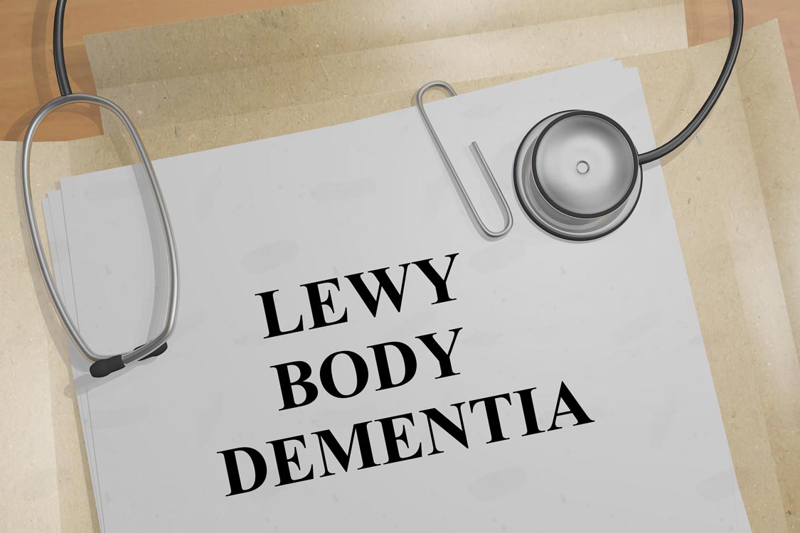 Lewy body disease onset could begin earlier than known - Medical Update ...