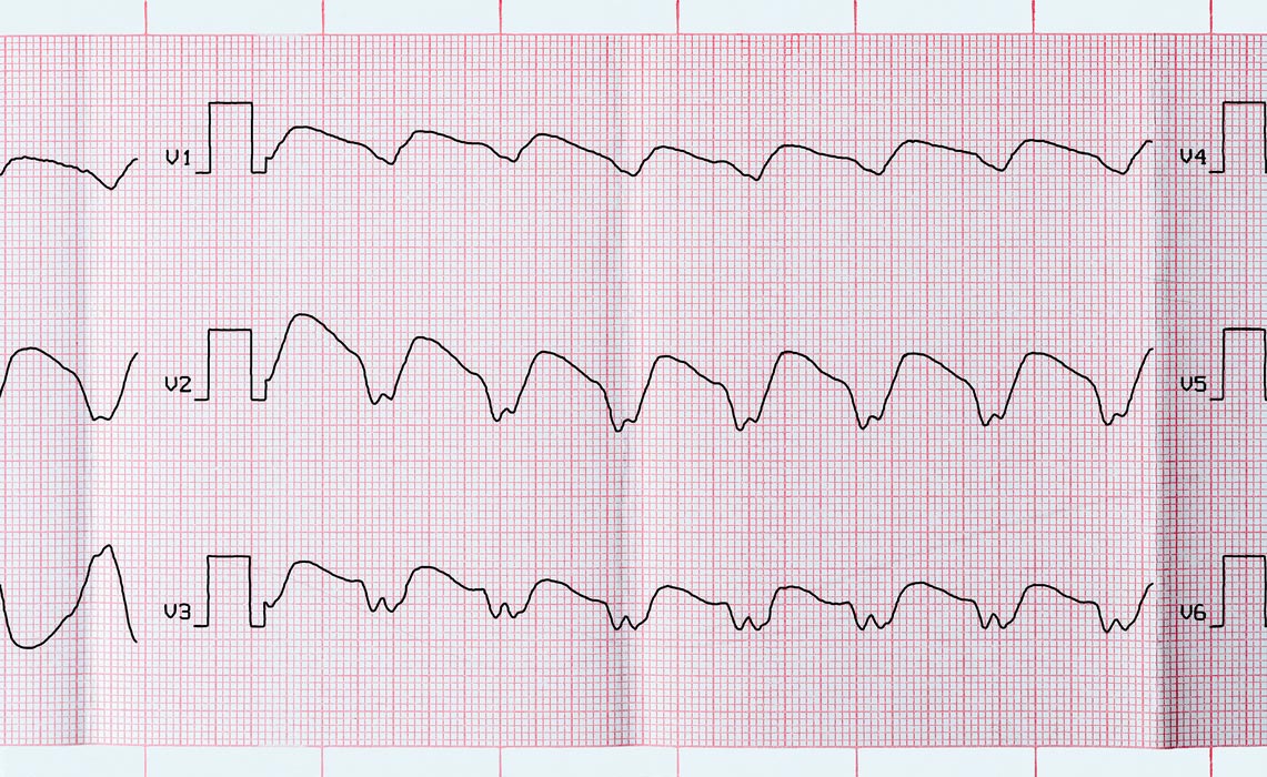 Presentation at European Society of Cardiology demonstrates VIVO ...