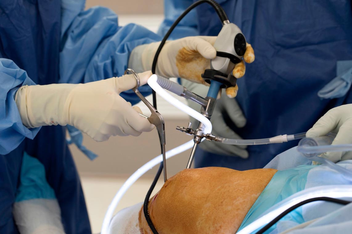Does altered gait following ACL surgery contribute to additional knee ...