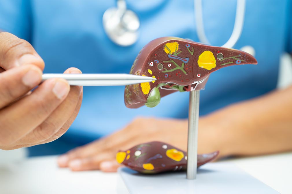Mortality risk rises with fatty liver disease - Medical Update Online