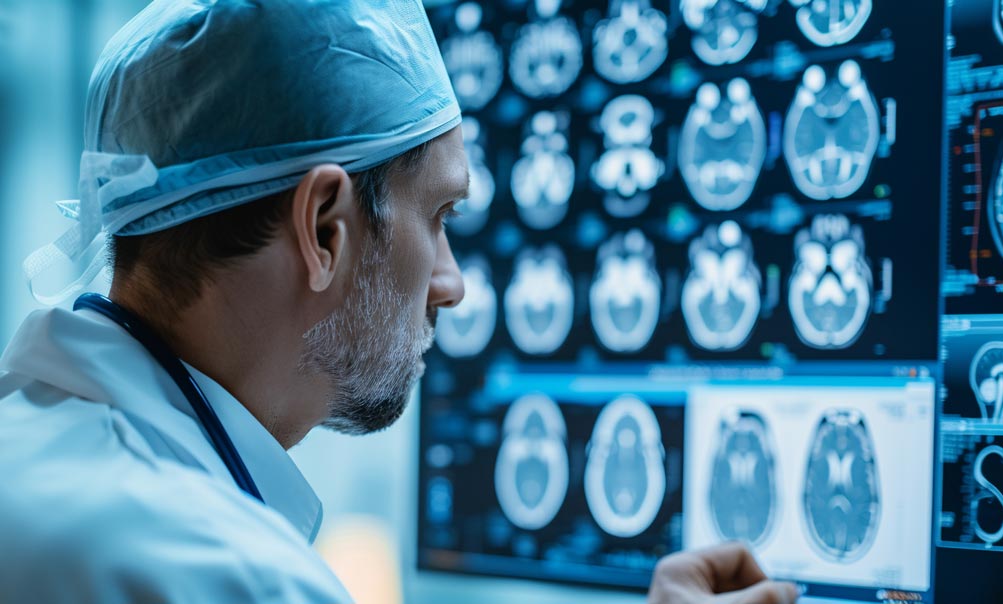 ProMIS Neurosciences highlights innovative approaches to Alzheimer’s ...