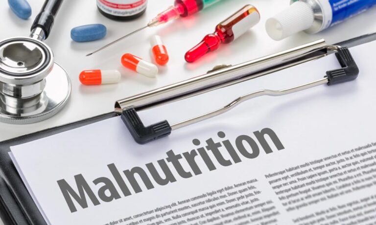 New guidance on diagnosing malnutrition in critically ill adults ...