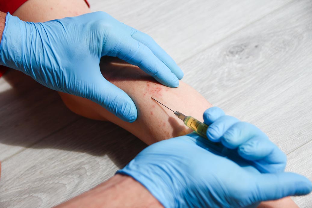 Ebglyss (lebrikizumab-lbkz) single monthly maintenance injection ...