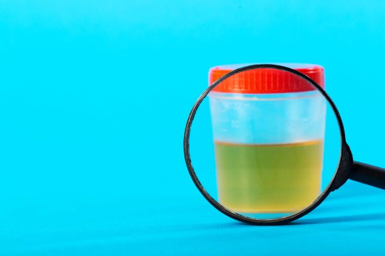 A simple urine test could revolutionize bladder cancer diagnosis and ...
